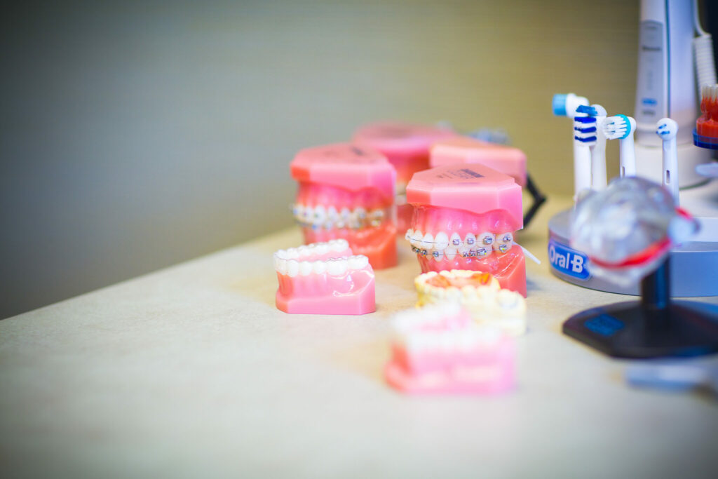 What Is an Overbite? Here’s What You Need to Know - iOrtho